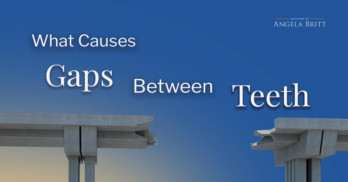 Gaps Between Teeth - Dentistry by Angela Britt